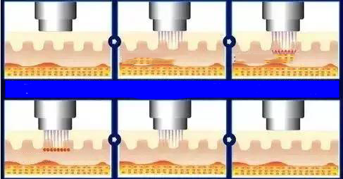 Desktop gold RF microcrystal