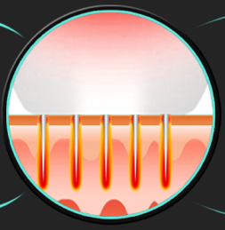Vertical gold RF microcrystal